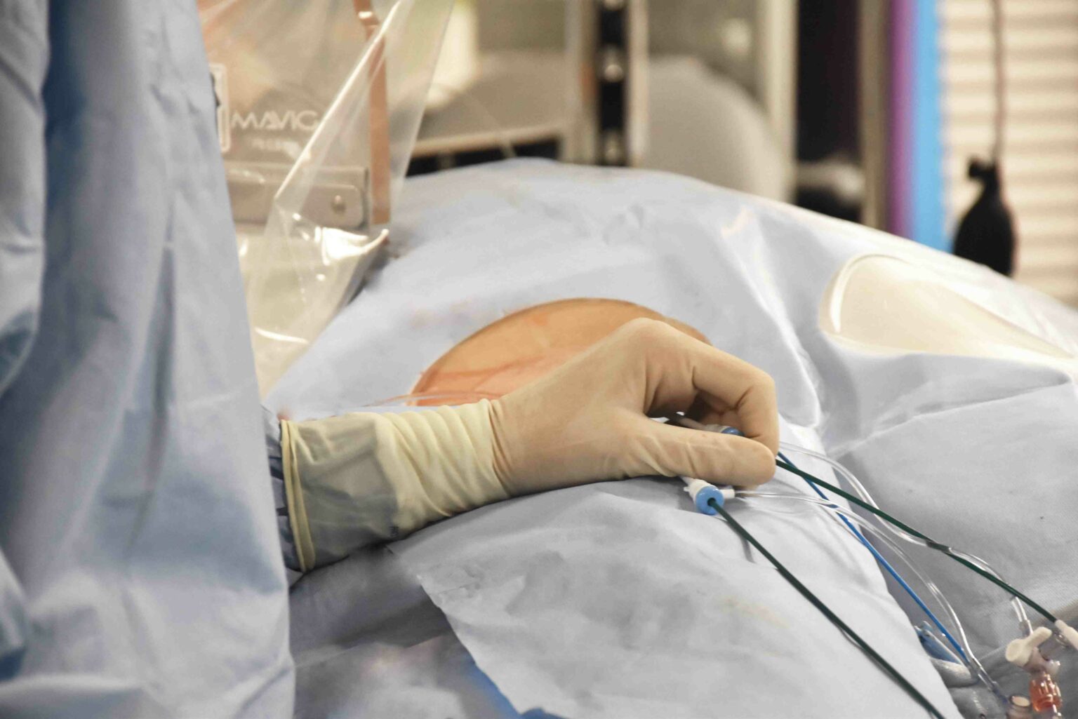 Ablation du flutter – rythmologie-pitie